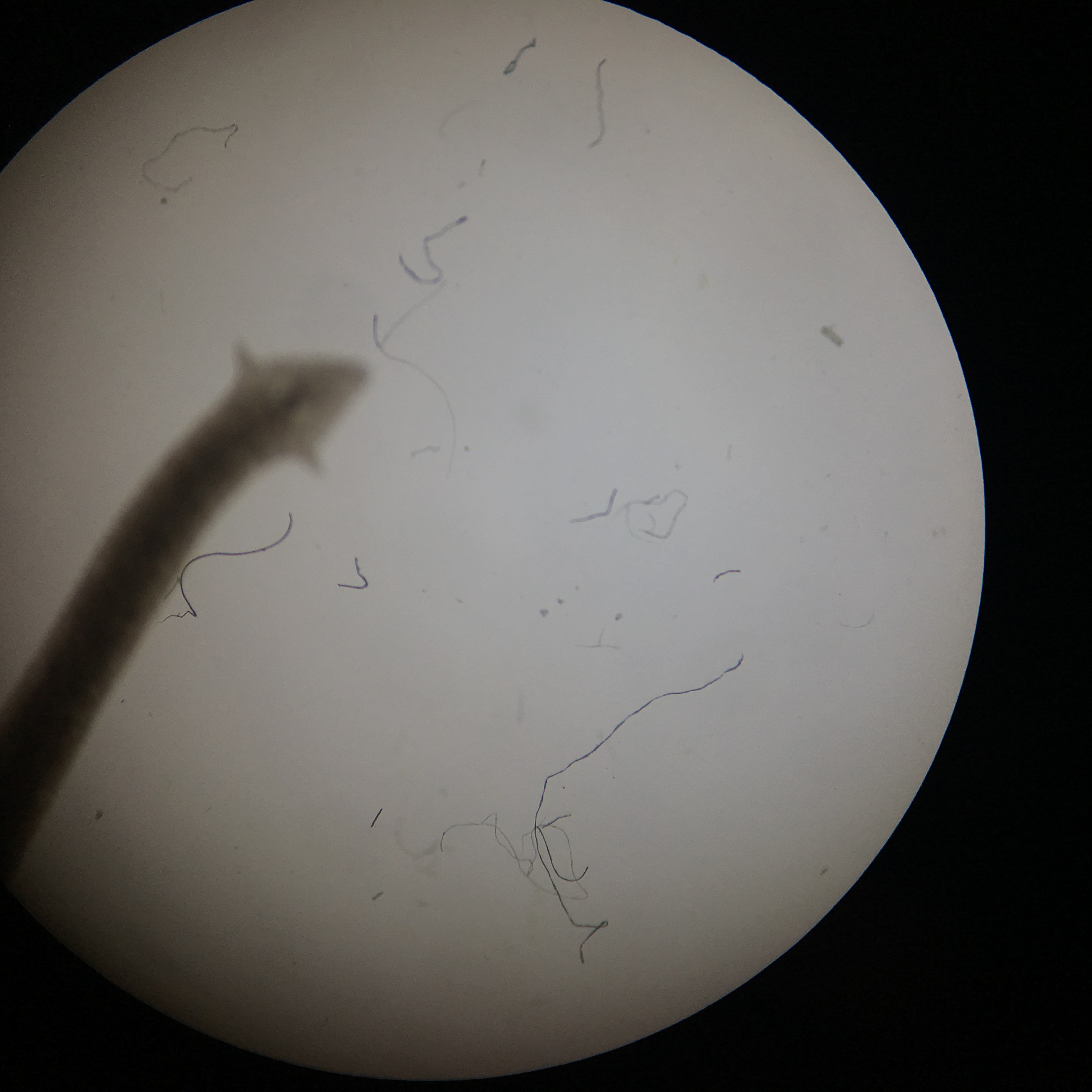 Planaria: The Miraculous Regenerating Worm – Afterlife Art