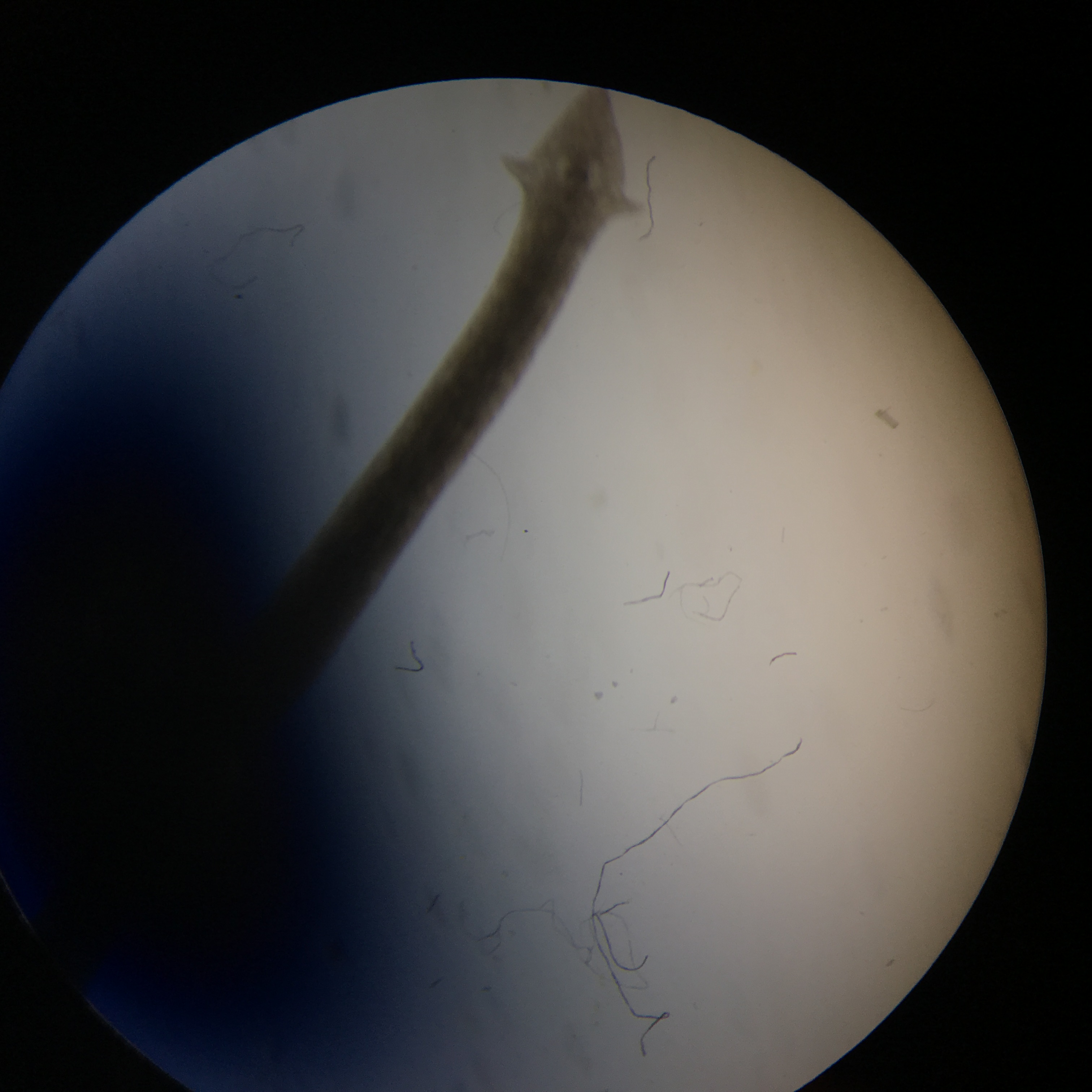 Planaria: The Miraculous Regenerating Worm – Afterlife Art